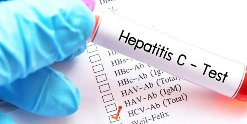 Lanzan campaña para buscar pacientes con hepatitis C para curarlos ...